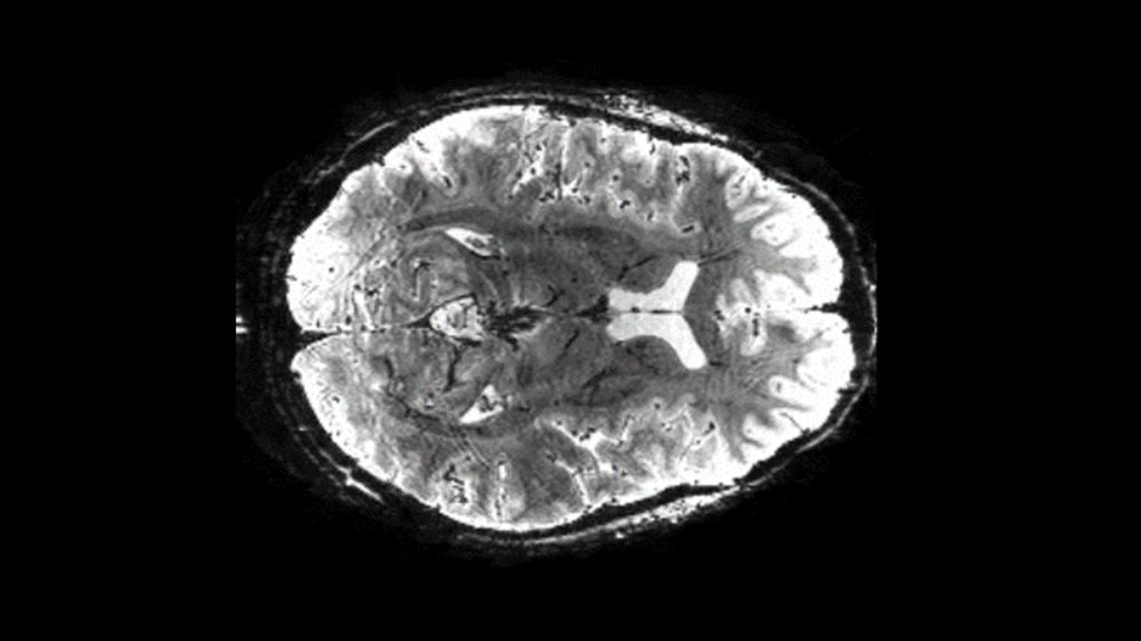 Lectures: MRI - FCBG Platforms